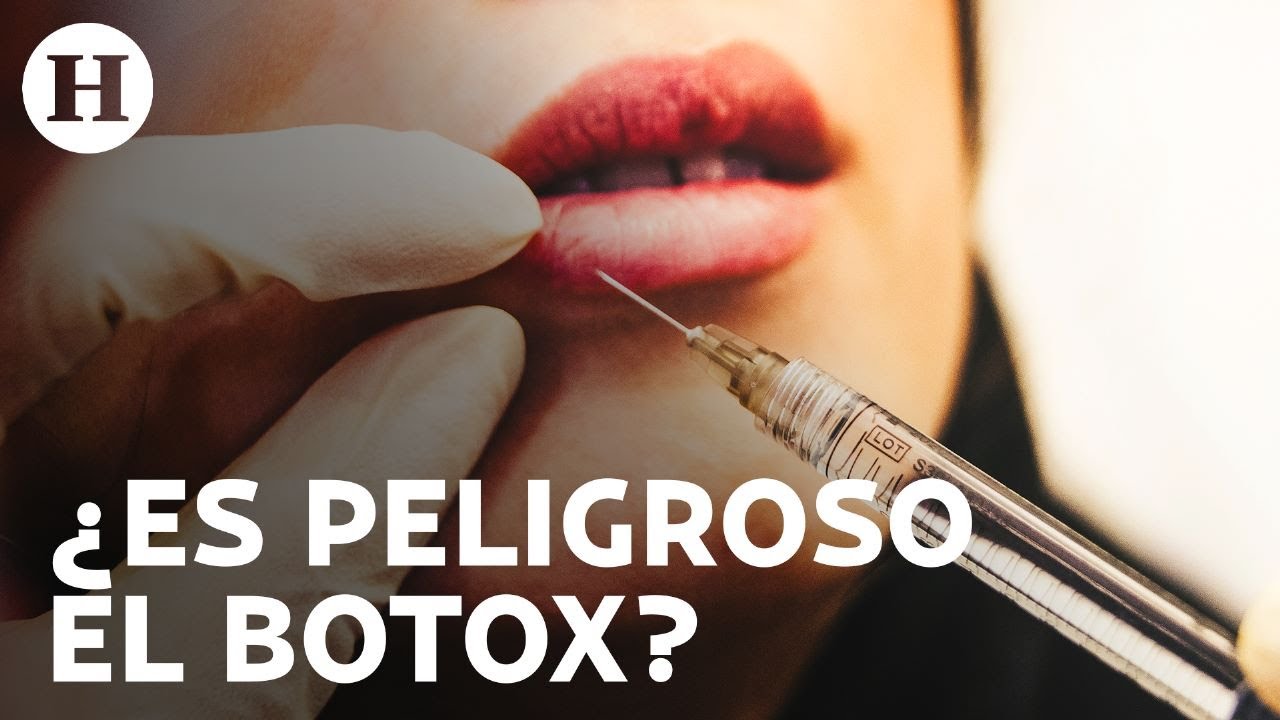 ¿Quién puede aplicar botox en México? - Edukar